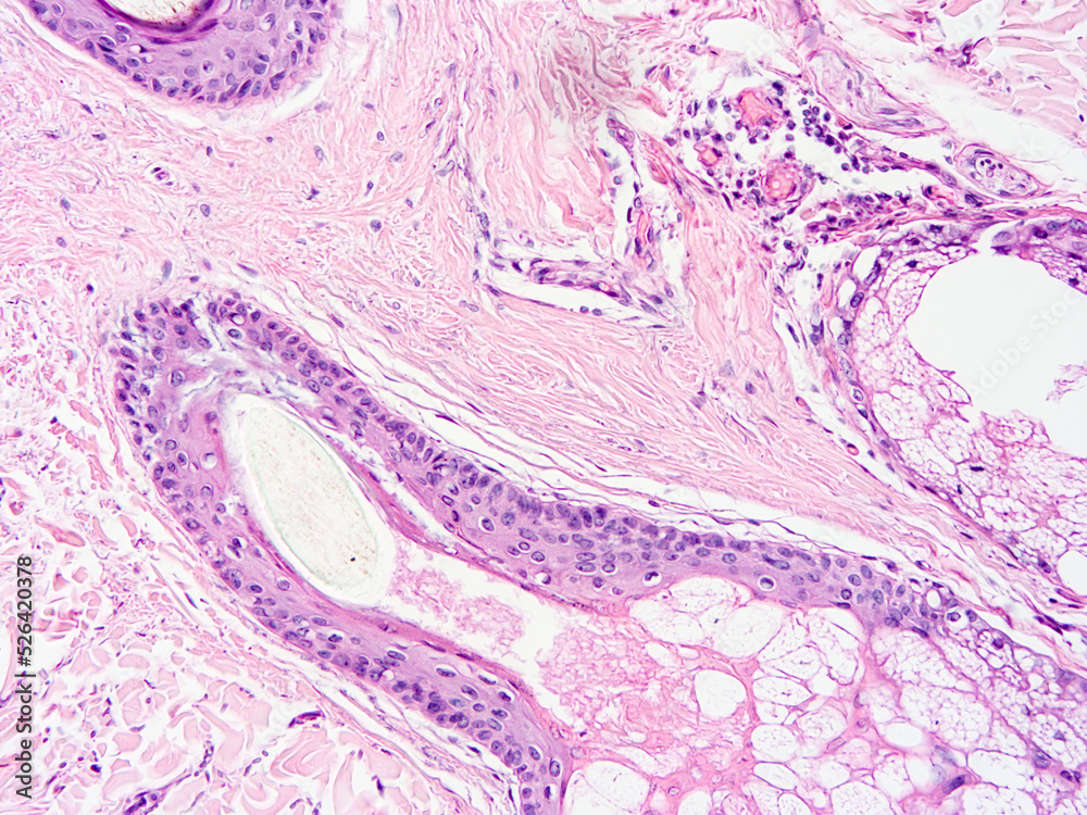 Histology of human tissue, show epithelial tissue and connective tissue ...