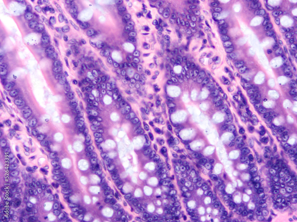 Histology of human tissue, show epithelial tissue and connective tissue ...