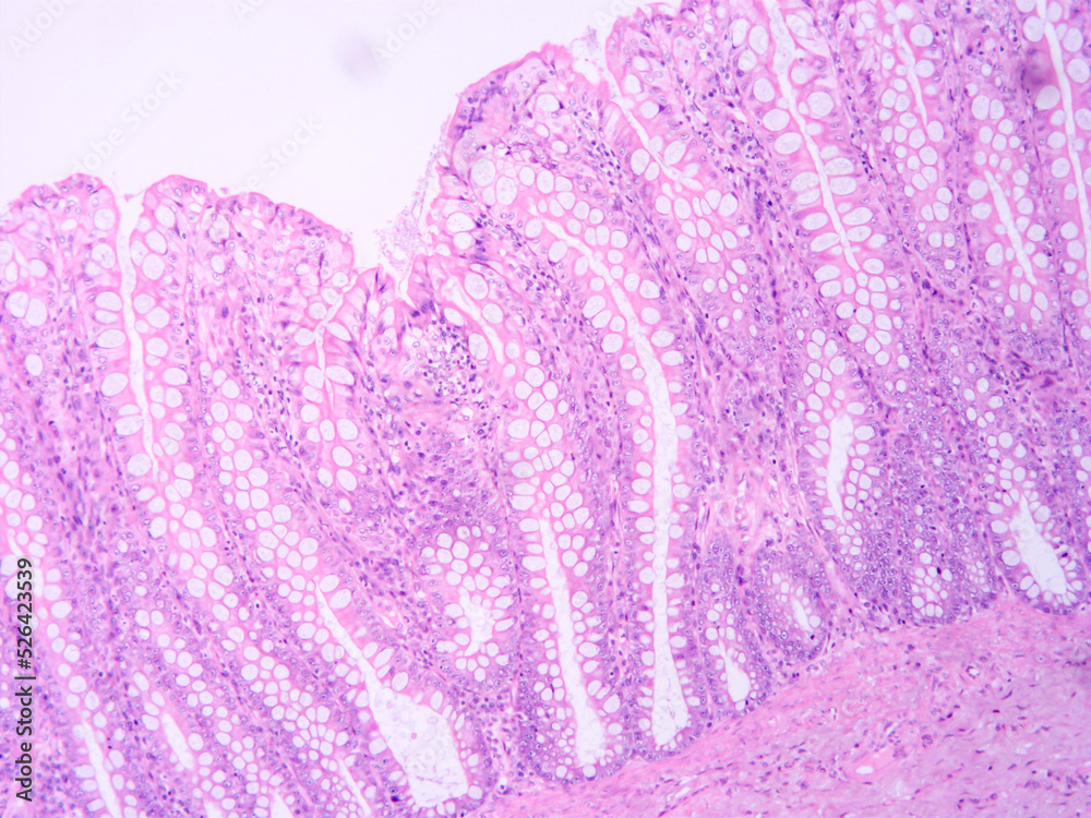 Histology of human tissue, show epithelial tissue and connective tissue ...