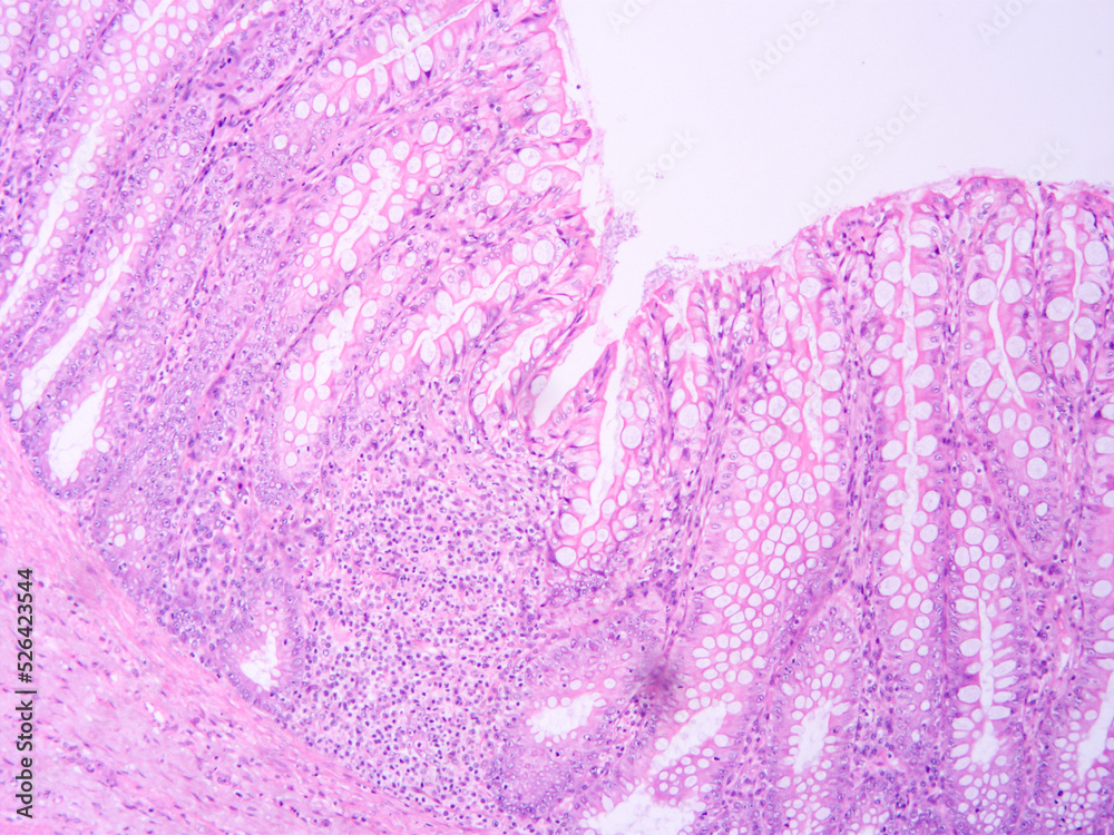 Histology of human tissue, show epithelial tissue and connective tissue ...