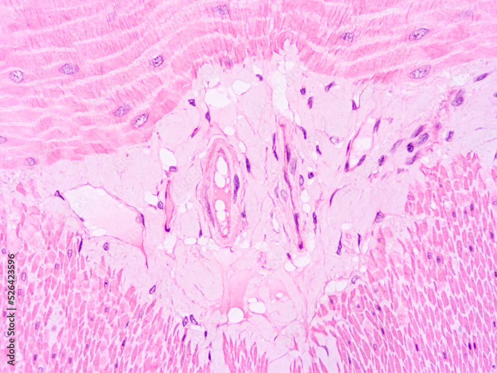 Histology of human tissue, show epithelial tissue and connective tissue ...