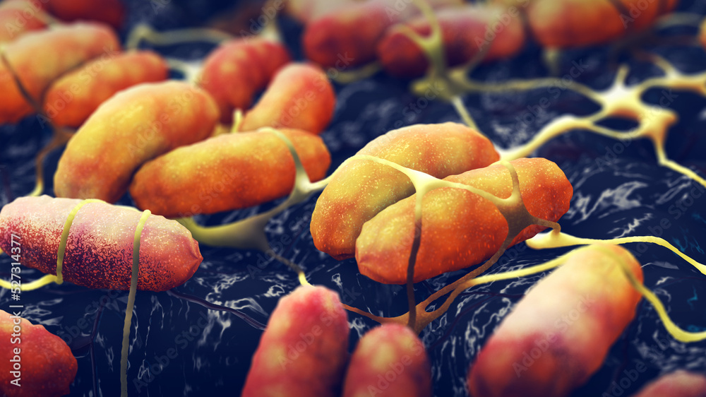 Plague is an infectious disease caused by Yersinia pestis bacteria ...