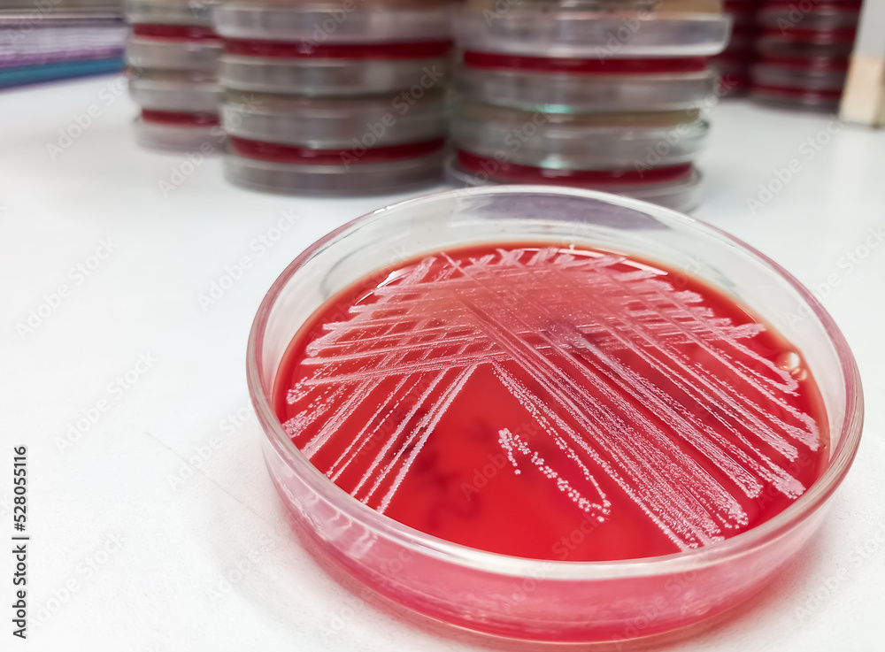 Blood agar medium growth of streptococcus, staphylococcus aureus, gram ...