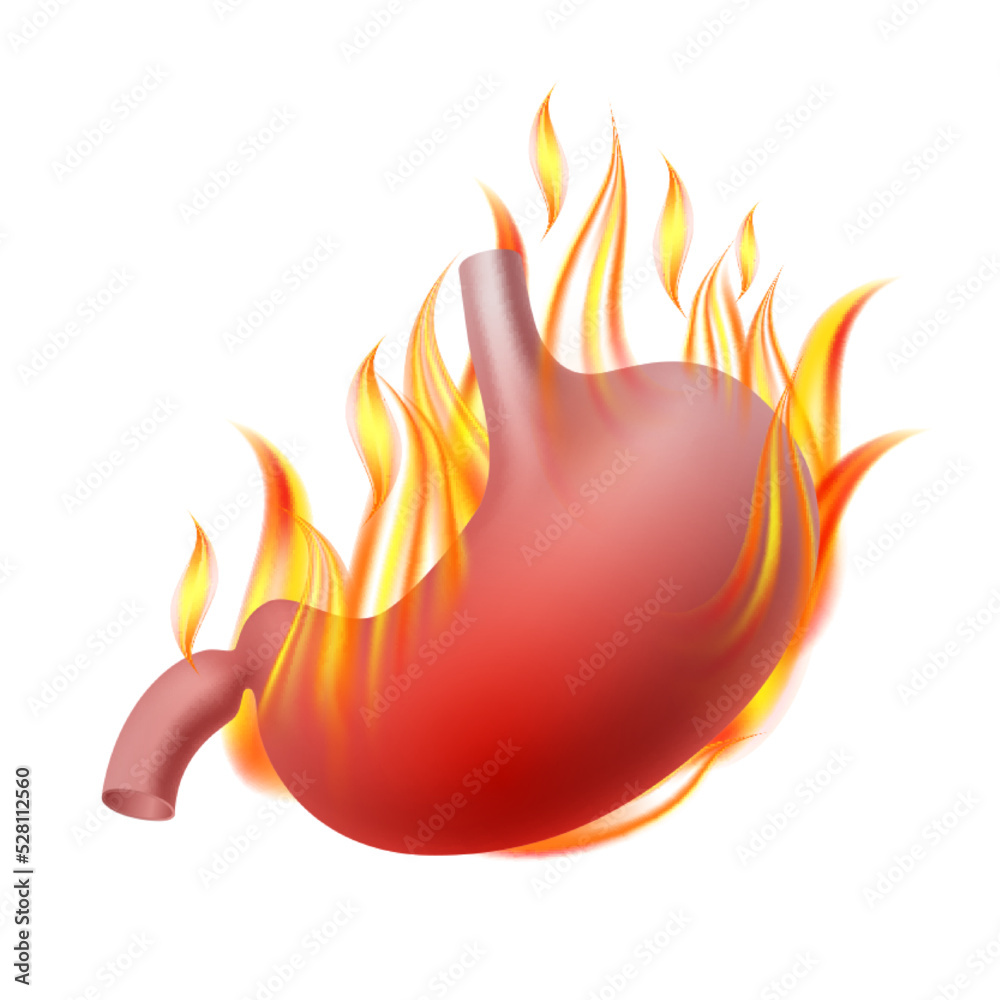 Burning stomach. Realistic human organ of internal digestion system on ...
