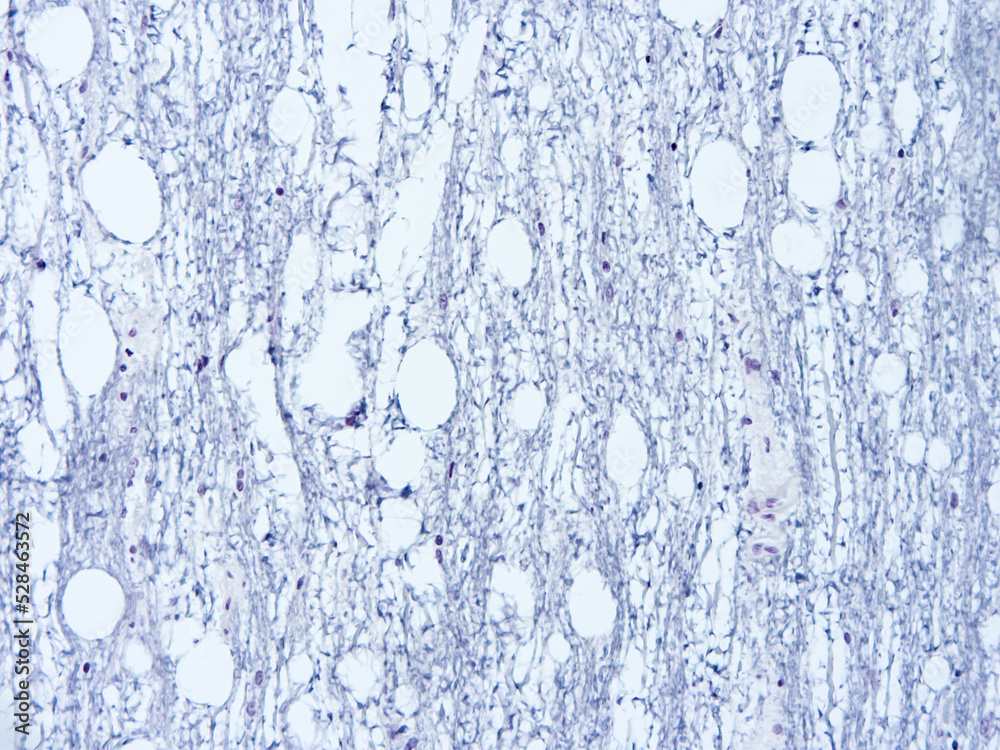 Histology of human tissue, show epithelial tissue and connective tissue ...