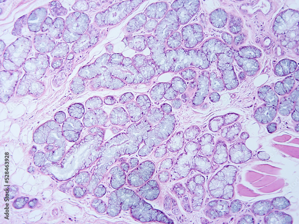 Histology of human tissue, show epithelial tissue and connective tissue ...