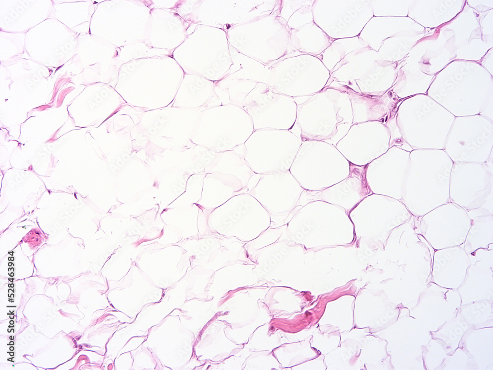 Histology of human tissue, show epithelial tissue and connective tissue ...
