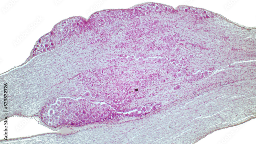 Pseudounipolar neurons. Dorsal root ganglion. Hematoxlyn and eosin ...