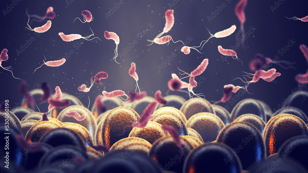Helicobacter Pylori is a gastrointestinal bacterium that can affect the ...