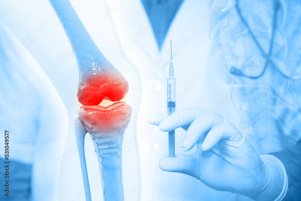 Anatomy Human Knee Joint Treatment, Osteoarthritis Injection, Drug ...