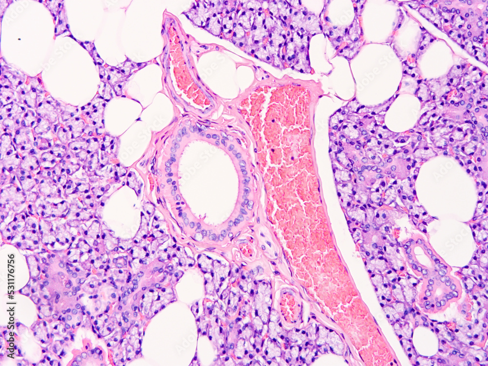 Histology of human tissue, show epithelial tissue and connective tissue ...