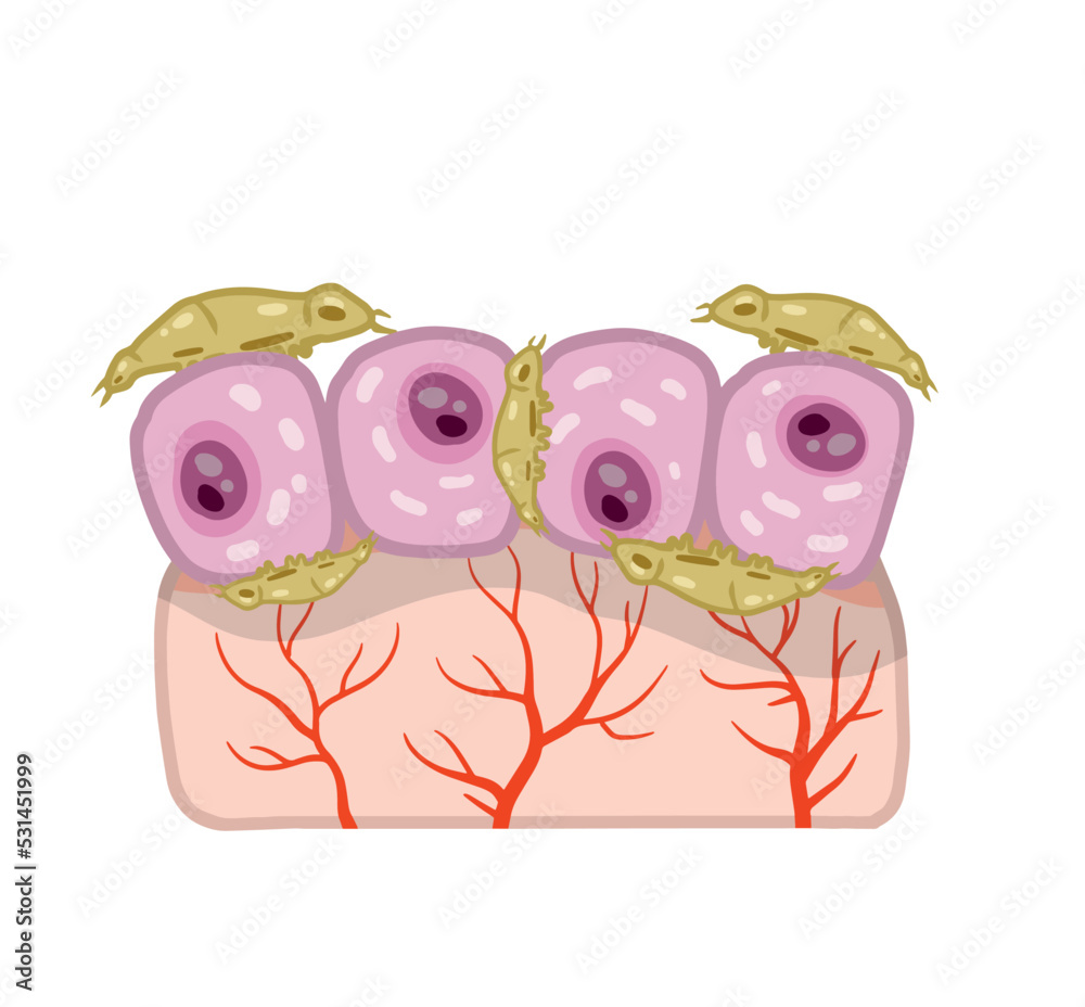 Subcutaneous tick. Skin parasite. Beetles on human epidermis. Harmful ...