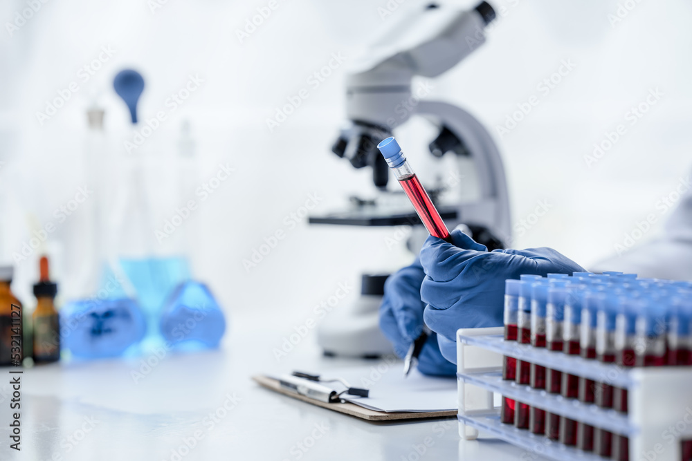 Laboratory and science experiments, chemical hand taking a blood sample ...