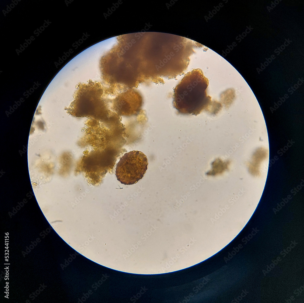 Ascaris lumbricoides egg microscope laboratory Stock Photo | Adobe Stock