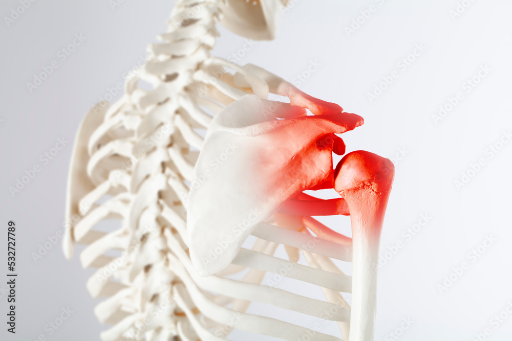 Shoulder blade pain, human skeleton body anatomy scapula and humerus ...