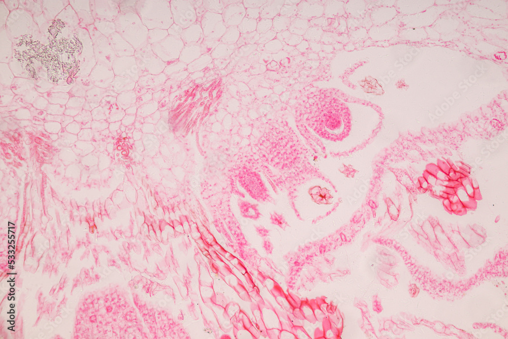 Plant tissue Structure, section (tissue) of stem plant tissue under a ...
