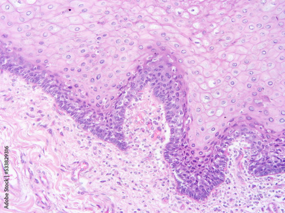 Histology of human tissue, show epithelial tissue and connective tissue ...