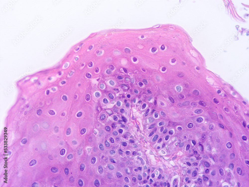 Foto de Stock Histology of human tissue, show epithelial tissue and ...