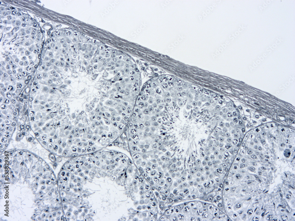 Histology of human tissue, show epithelial tissue and connective tissue ...
