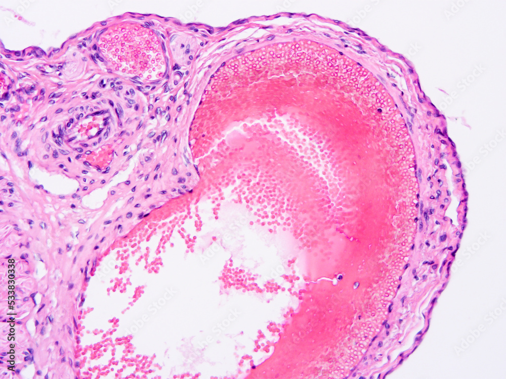 Histology of human tissue, show epithelial tissue and connective tissue ...