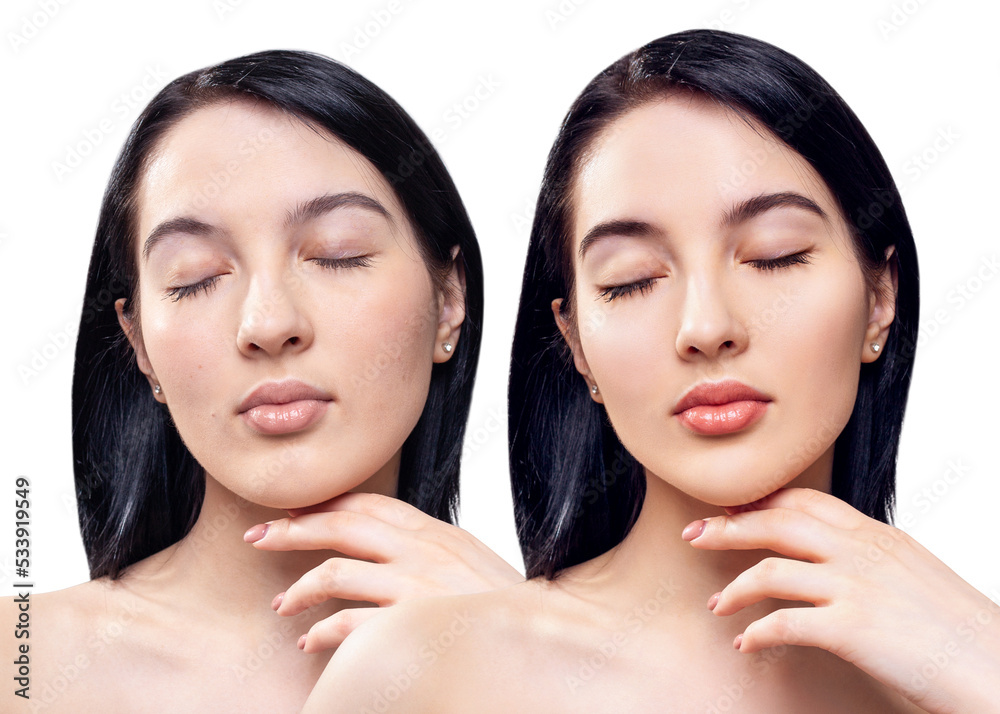 Beautiful woman before and after skin retouch or makeup. Stock Photo ...