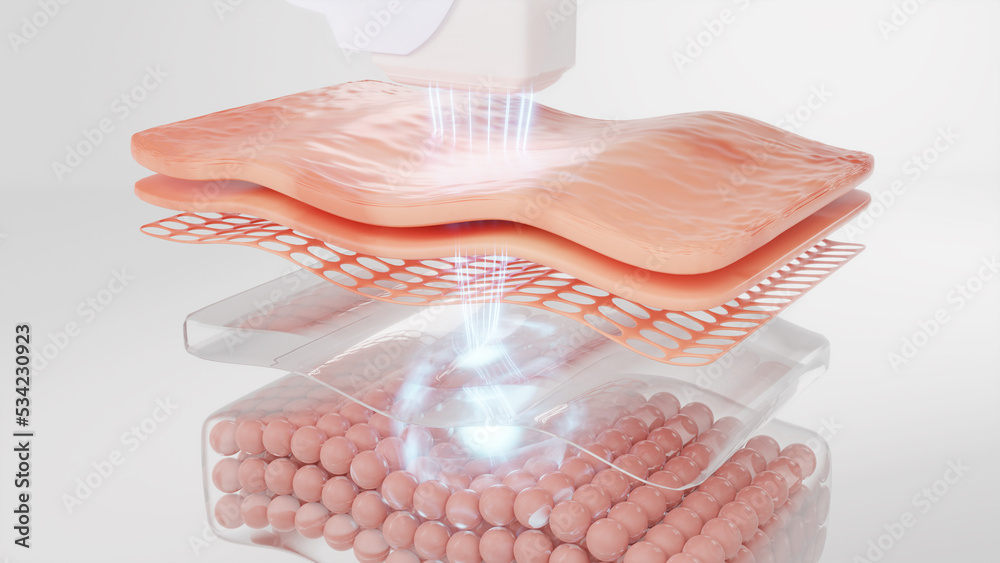 Facial treatment HIFU laser machine shot laser light through skin cell ...