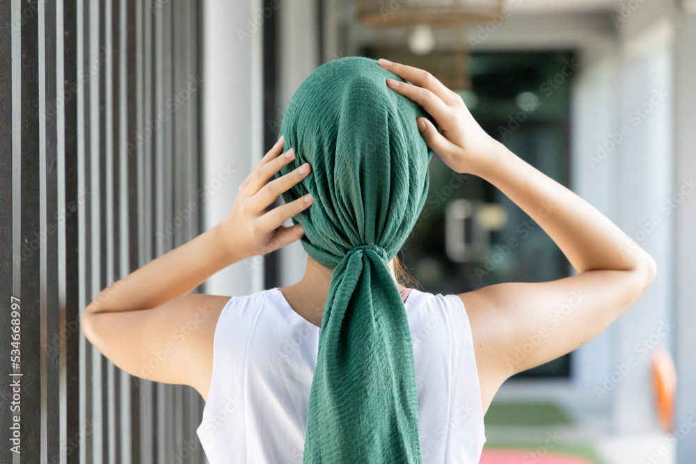 Back view of woman cancer patient suffering from alopecia areata, local ...
