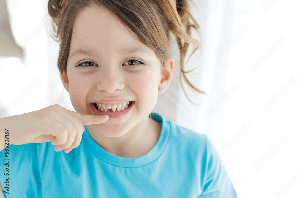 The child has lost a tooth. Little girl without a tooth. The first ...