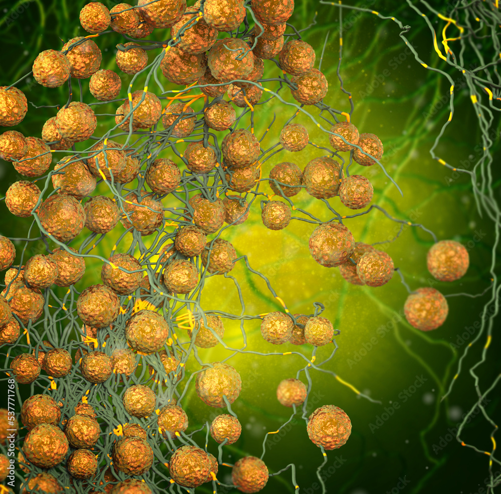 Medical background, Staphylococcus aureus, a type of spherical gram ...