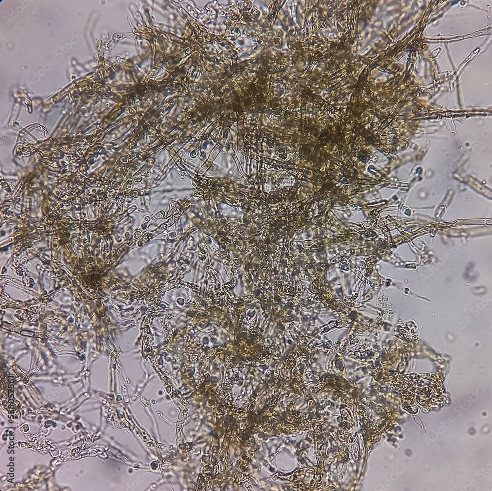 Microscopic fungi Malassezia furfur, showing yeast cells and hyphae ...