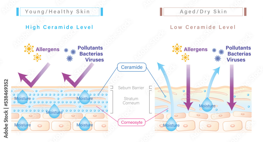 Ceramide in skin and skin barrier illustration comparing between young ... Ceramide in skin and skin barrier illustration comparing between young ...