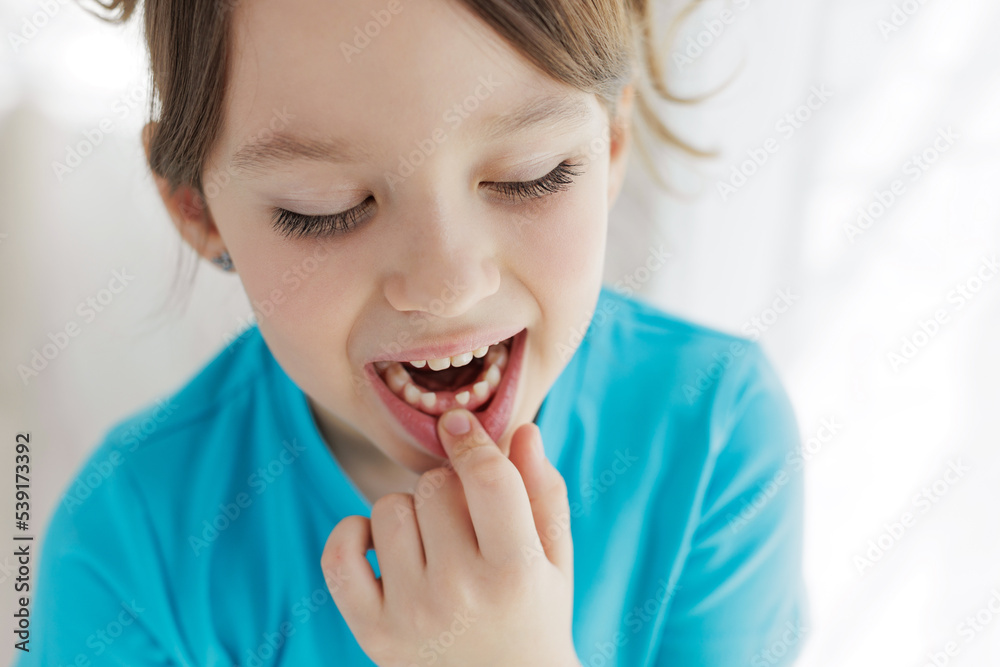 The child has lost a tooth. Little girl without a tooth. The first ...