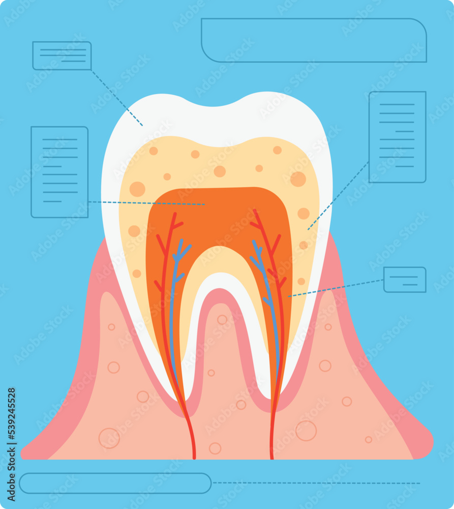 Tooth anatomy medical poster. Dental structure infographic Stock Vector ...