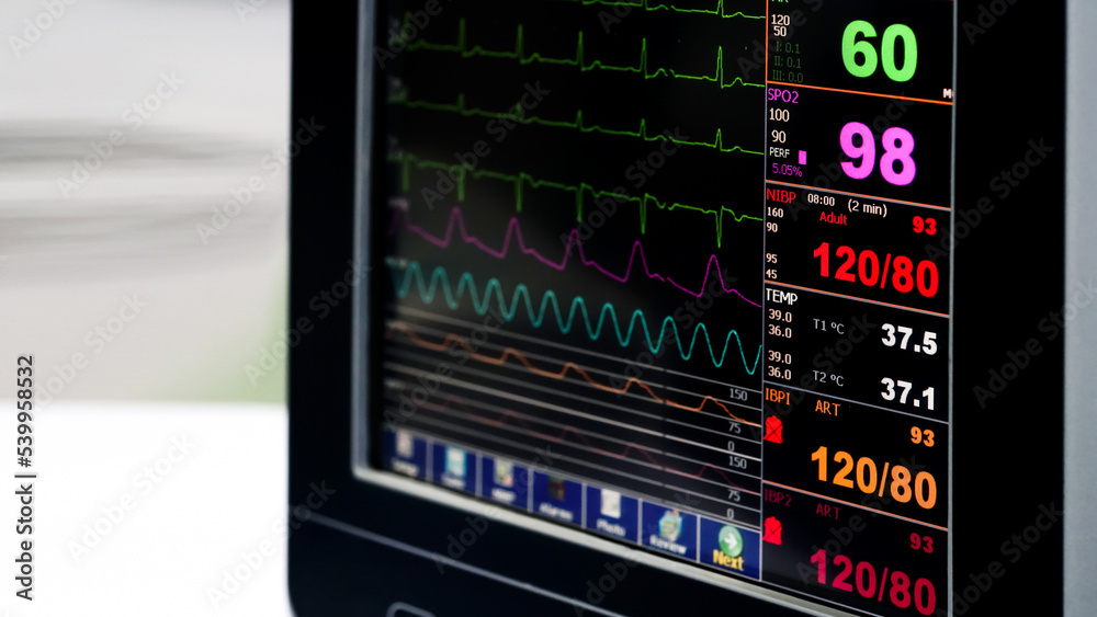 Patient monitor displays vital signs ECG electrocardiogram EKG, body ...