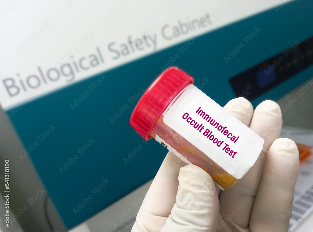 Sample container with stool sample for Immunofecal occult blood test ...