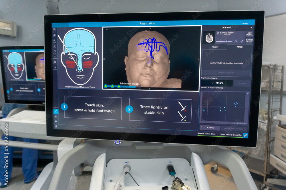 Step by step Visualase is an MRI-guided laser ablation system used to ...