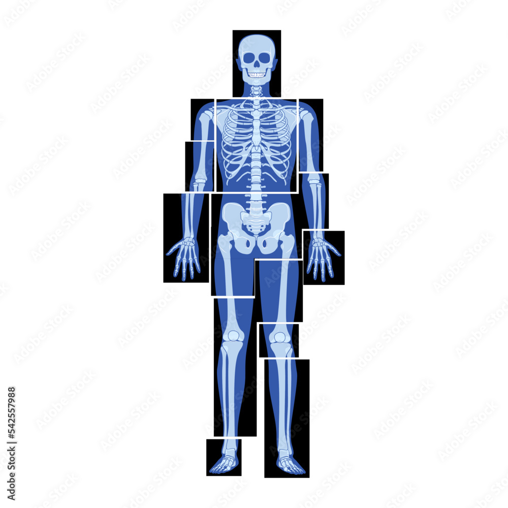 Vector de Stock Set of X-Ray Skeleton Human body parts - hands, legs ...