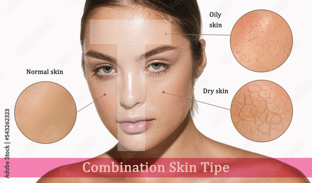 Female face with different skin types - dry, oily, normal, combination ...