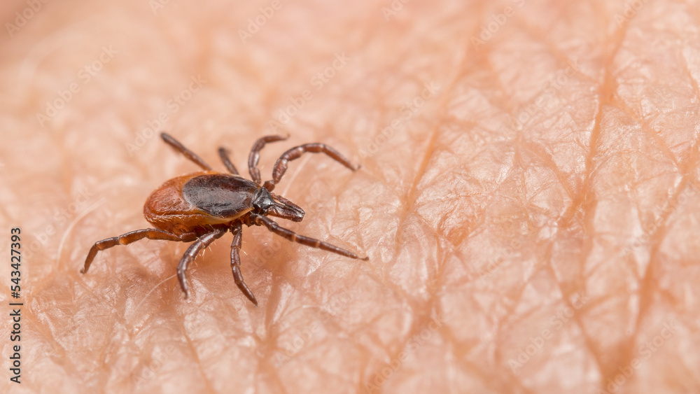 Closeup of female deer tick parasite on human skin background. Ixodes ...