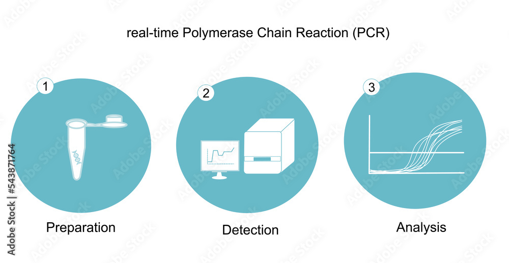 The important workflow (preparation, detection and analysis) of real ...