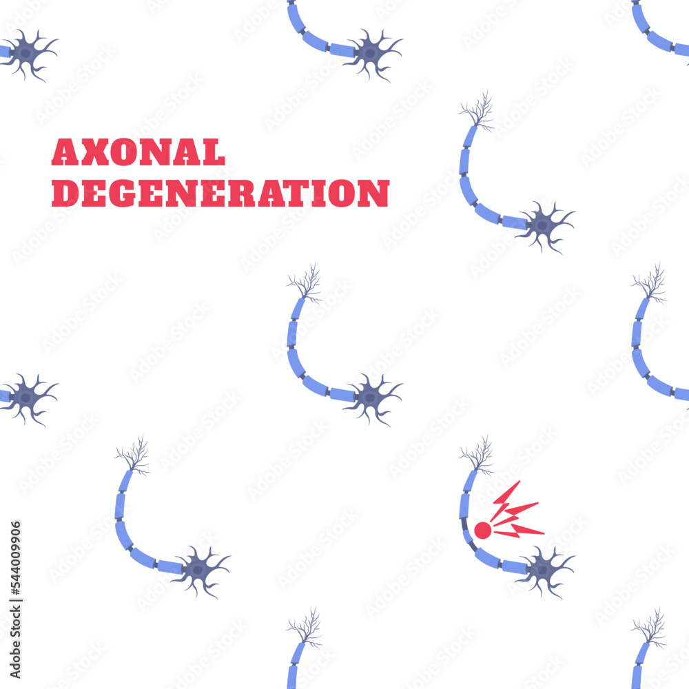 Axonal nerve degeneration. Loss of communication between neurons. NAD ...