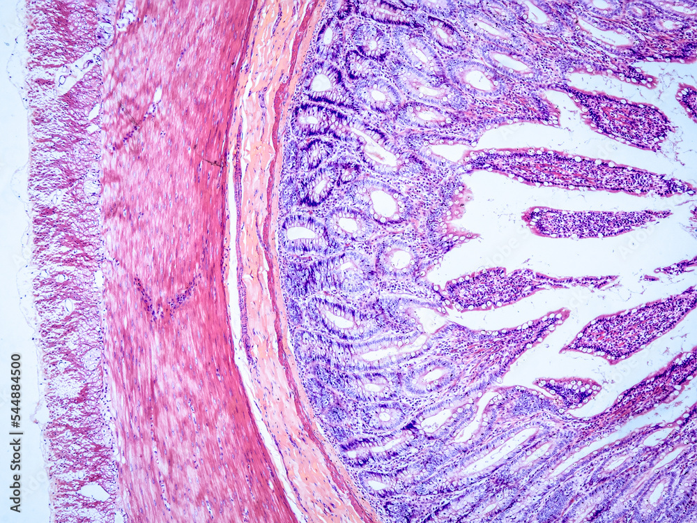 small intestine cross section under the microscope - optical microscope ...
