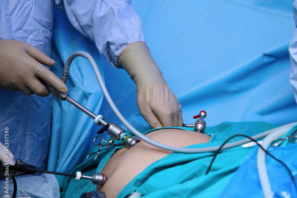 The surgeon's holing the instrument in abdomen of patient. The surgeon ...