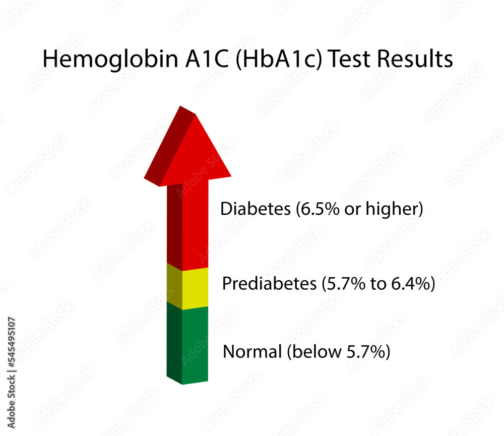 Stock-Vektorgrafik „Hemoglobin A1C, HbA1c test results, glycated ...
