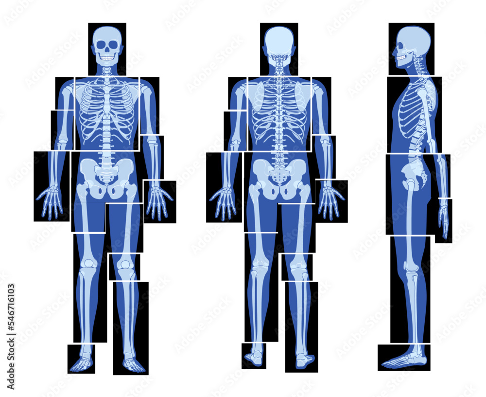 Set of X-Ray Skeleton Human body parts - hands, legs, chest, head ...