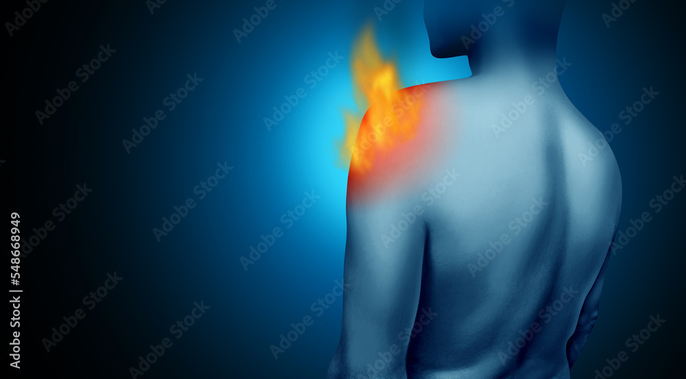 Burning Shoulder Pain and painful rotator cuff joint pain and tendon ...