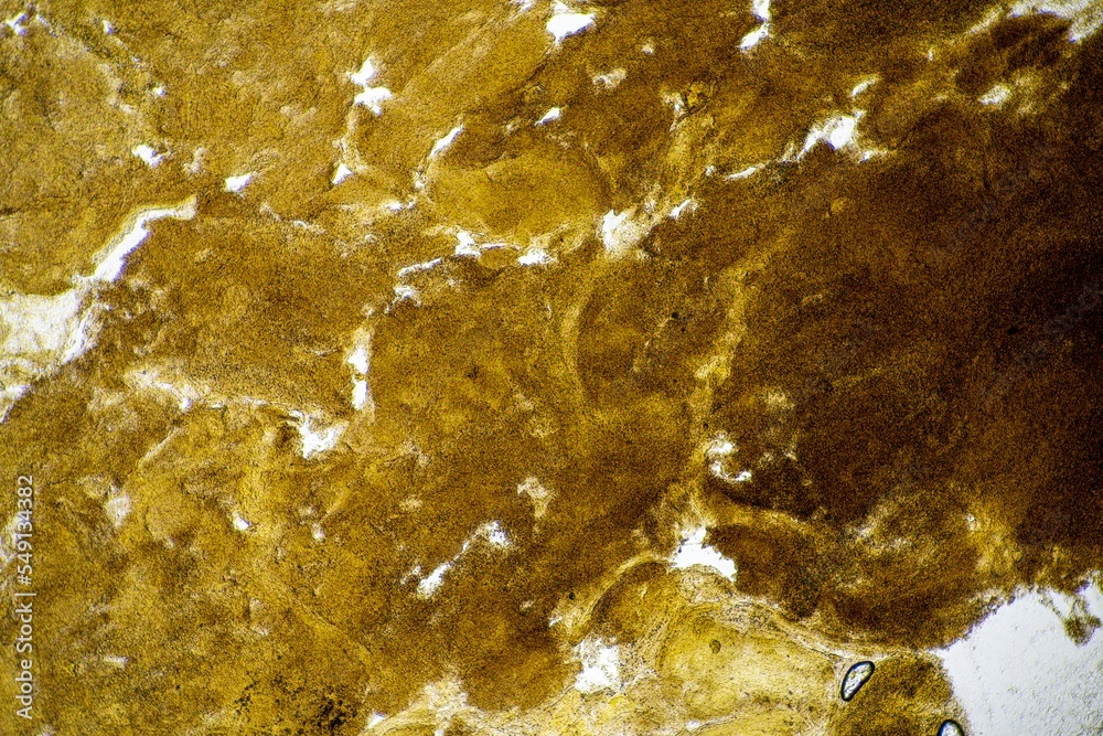 baby faeces under the microscope looking at poo with bacteria and bugs ...