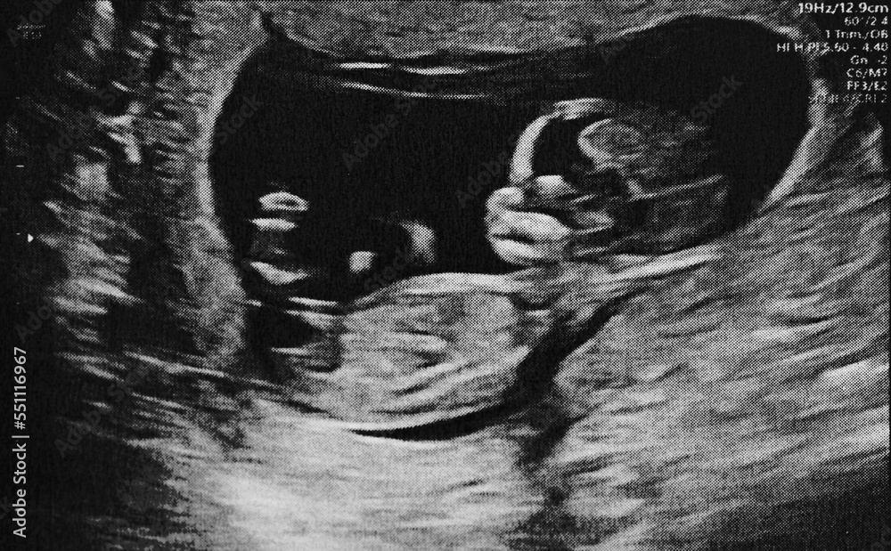 Pregnant baby infant ultrasound display. Mother belly screen in ...