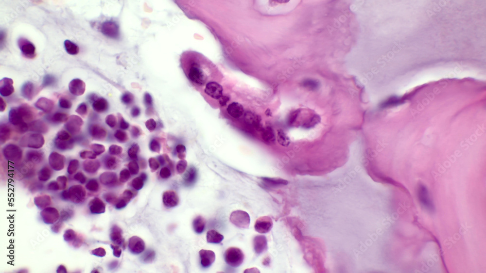 Osteoclast. Light micrograph of an osteoclast displaying typical ...