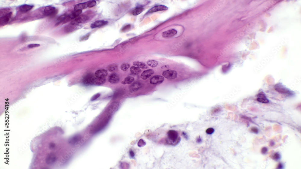 Osteoclast. Light micrograph of an osteoclast displaying typical ...